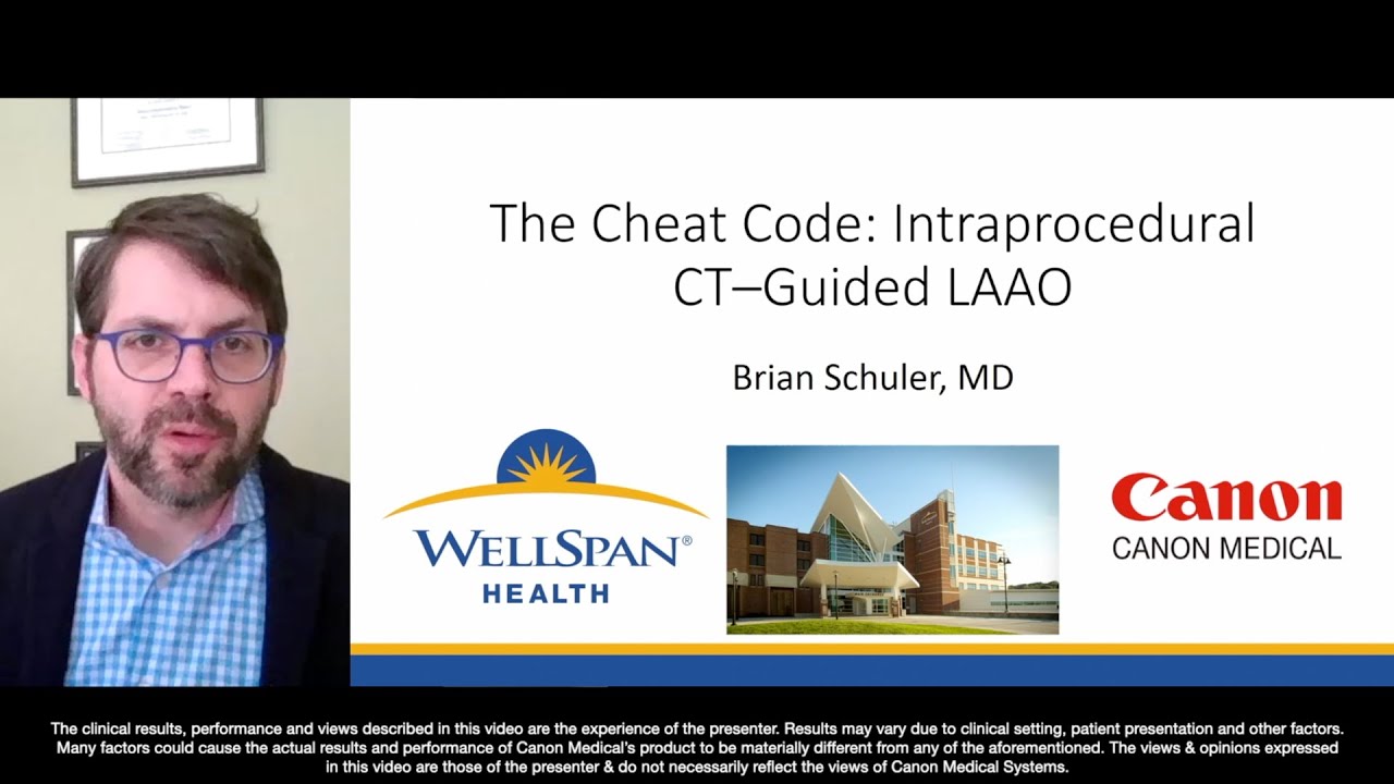 The Cheat Code: Intraprocedural CT-Guided LAAO - YouTube
