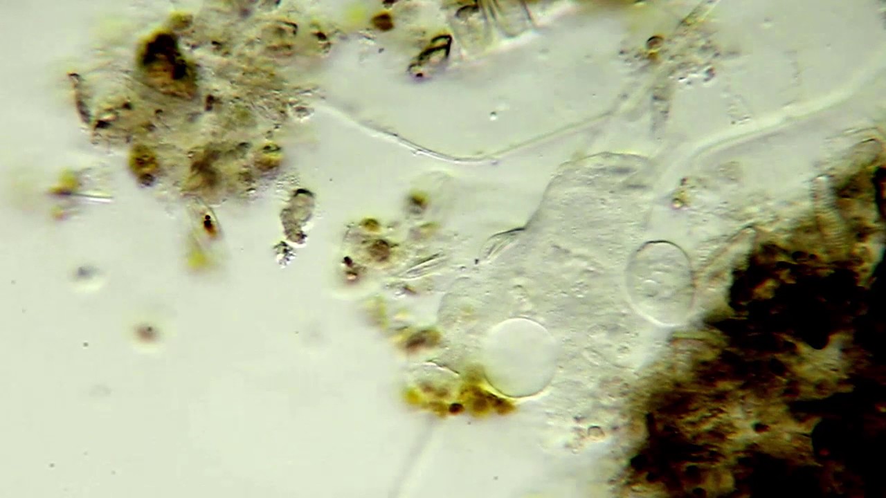 Amoeba on the move, meets vorticellid - YouTube