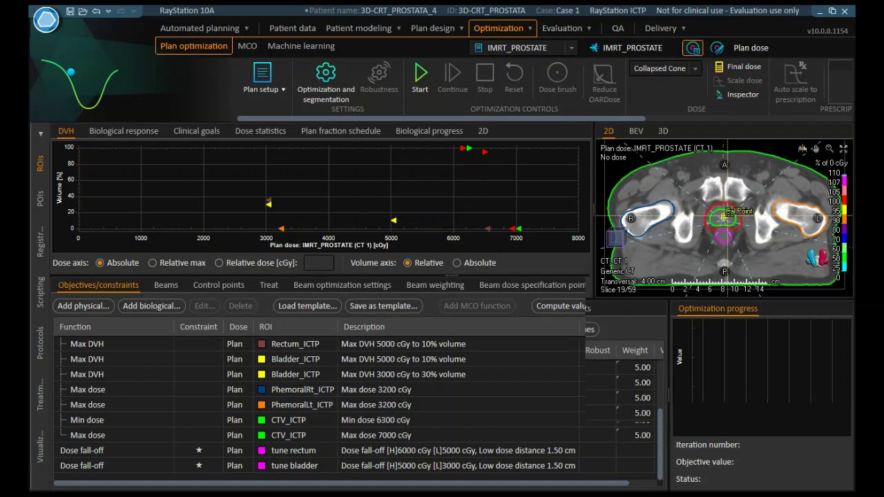 IMRT Prostate vs 3D planning with Raystation - YouTube