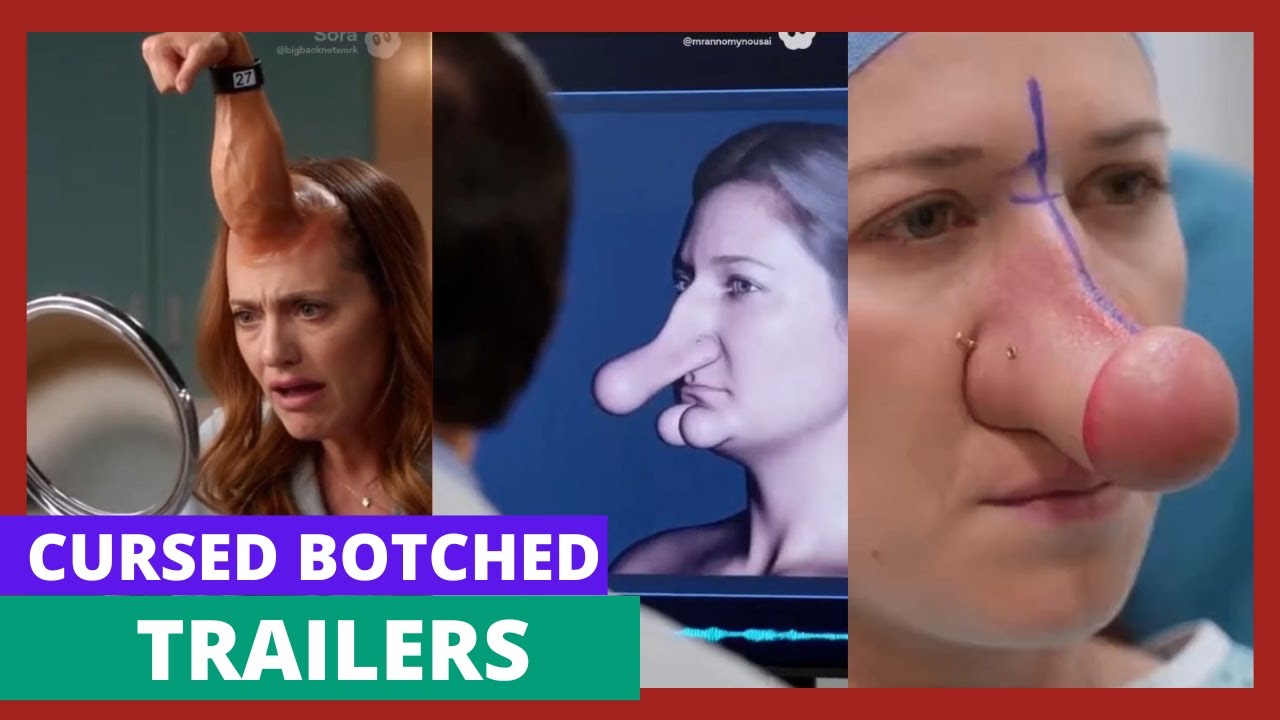 These AI generated Botched trailers are truely cursed! - YouTube