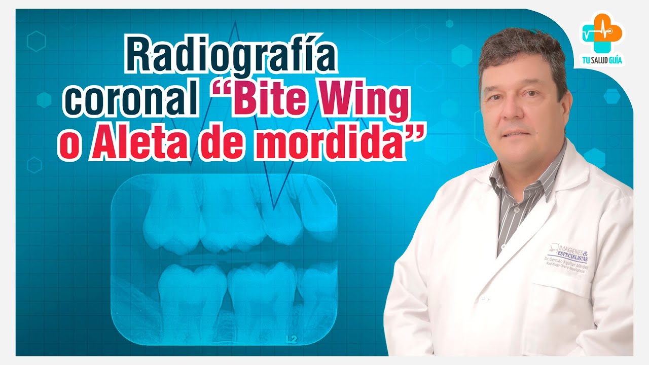 Radiografía Coronal "Bite Wing" o "Aleta de Mordida" | Tu Salud Guía ...