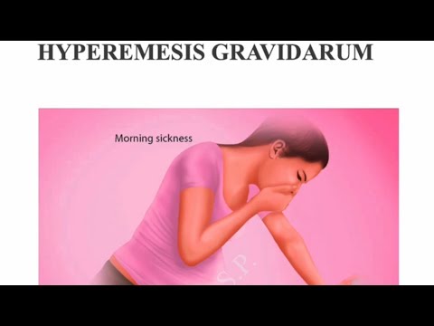 Hyperemesis Gravidarum | Nausea and Vomiting During Pregnancy | Sandhya ...