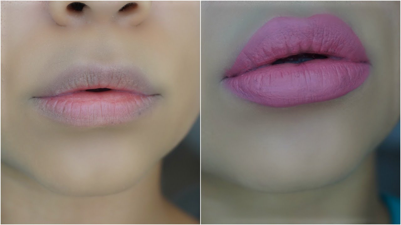 Instagram Hot Item | Candy Lipz Lip Plumper! Does it Work? - YouTube