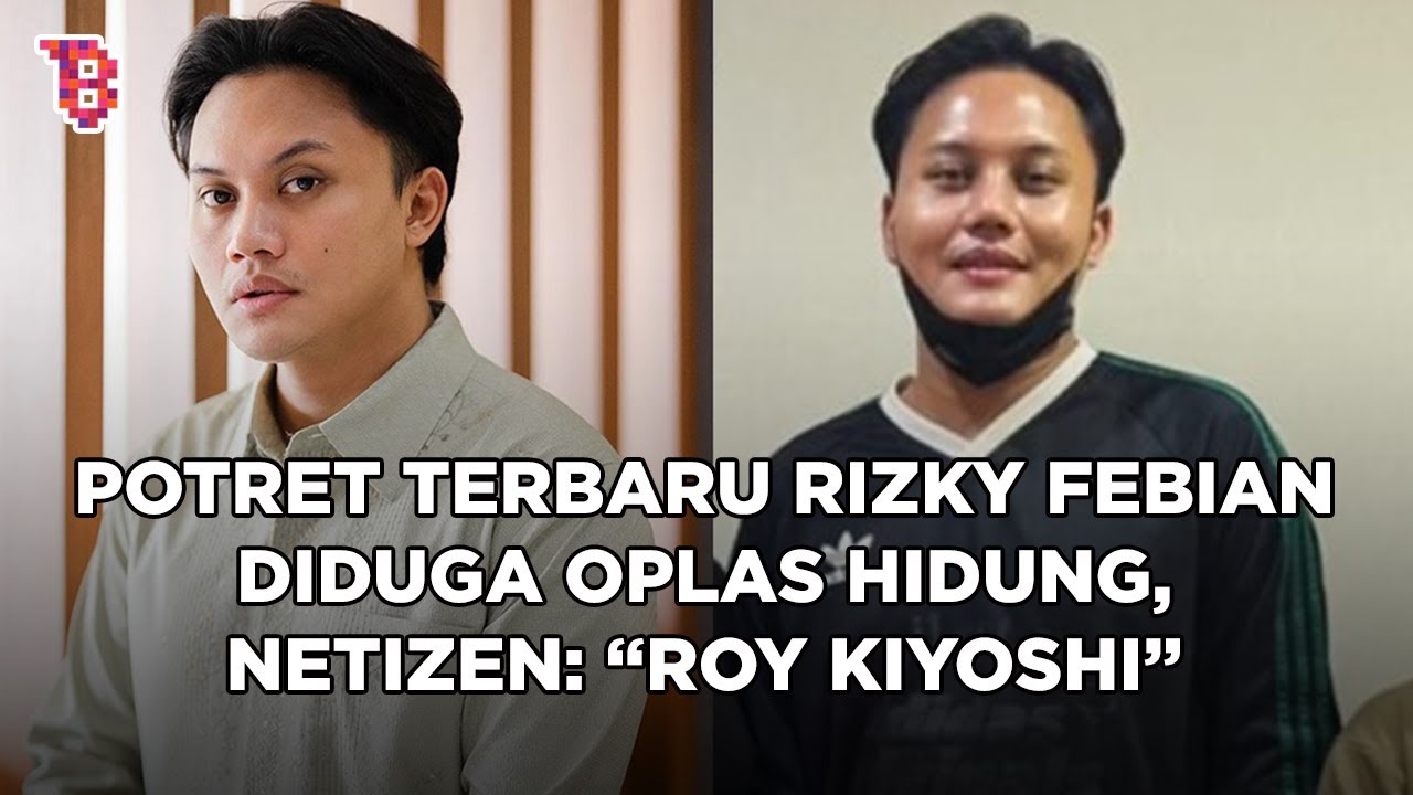 Hidung makin mancung, penampilan terbaru Rizky Febian bikin heboh ...