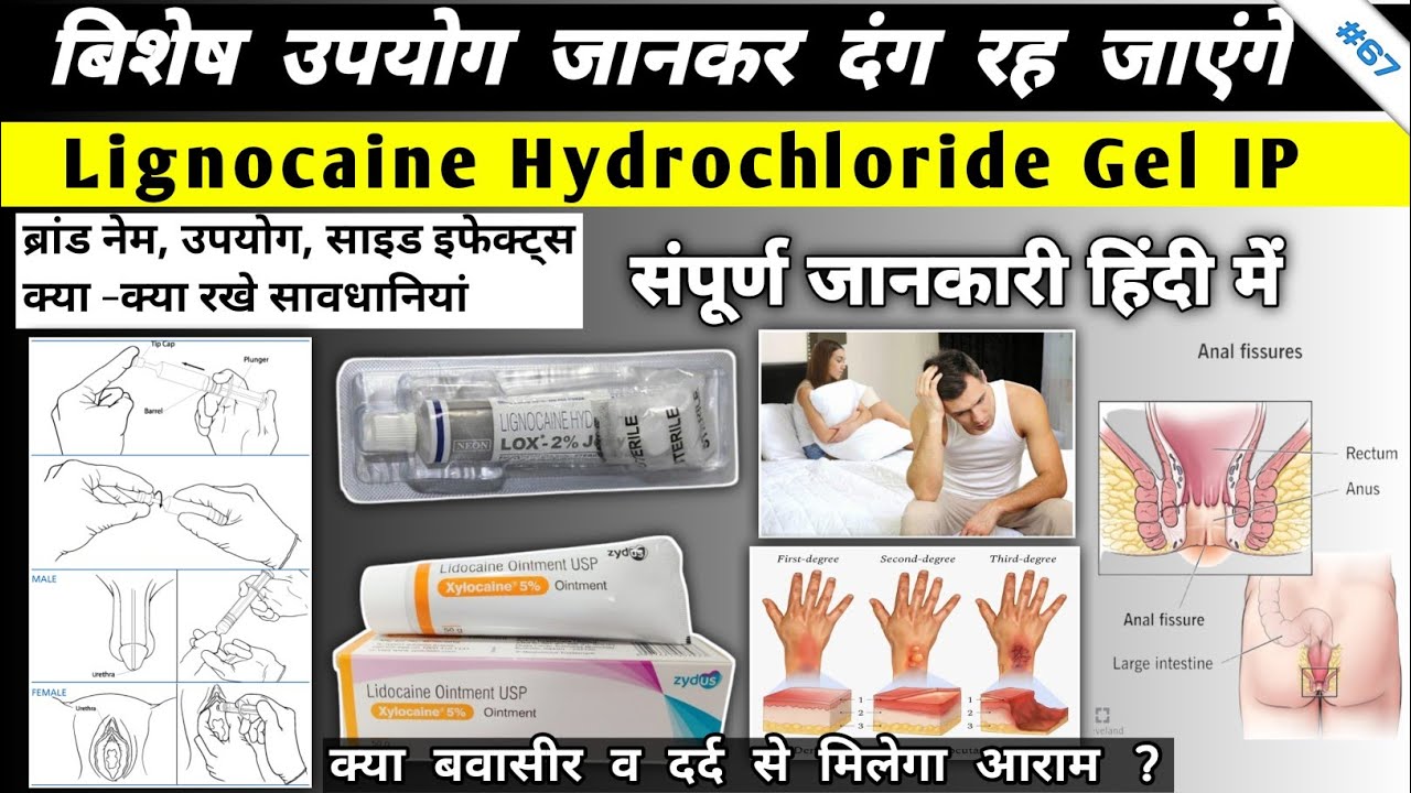 Lignocaine Hydrochloride Gel IP | Xylocaine 2% Jelly How to Use | Lox 2 ...