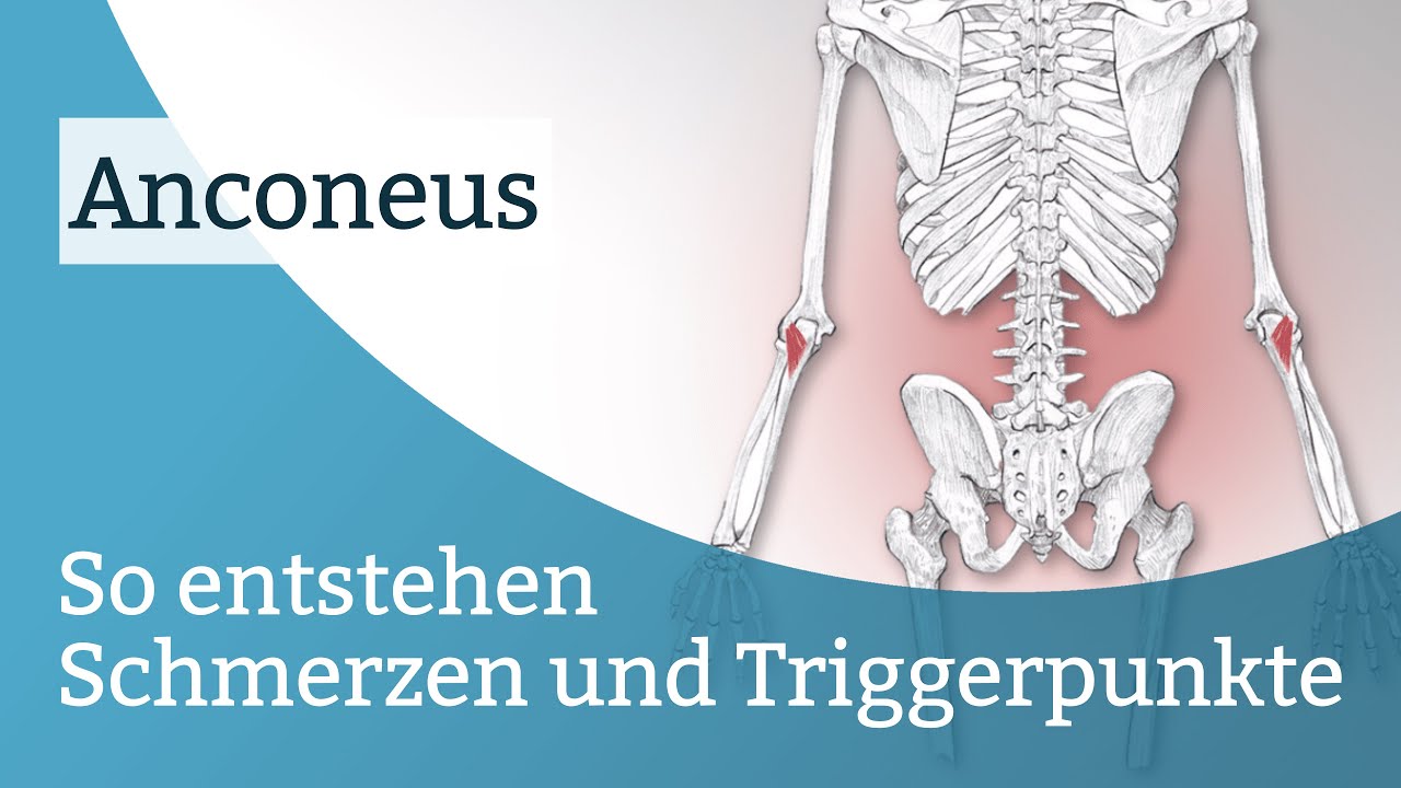 Anconeus Schmerzen, Triggerpunkte und deren Aktivierung - YouTube
