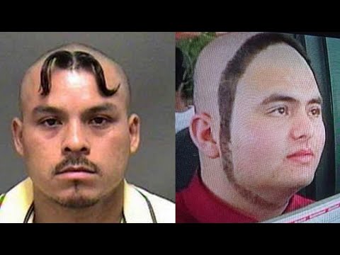 Worst Hairlines