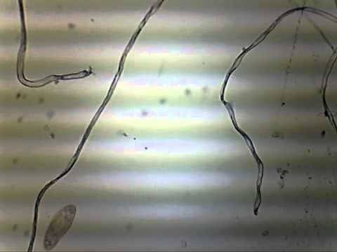 Thigmotaxis of Paramecium Caudatus - YouTube