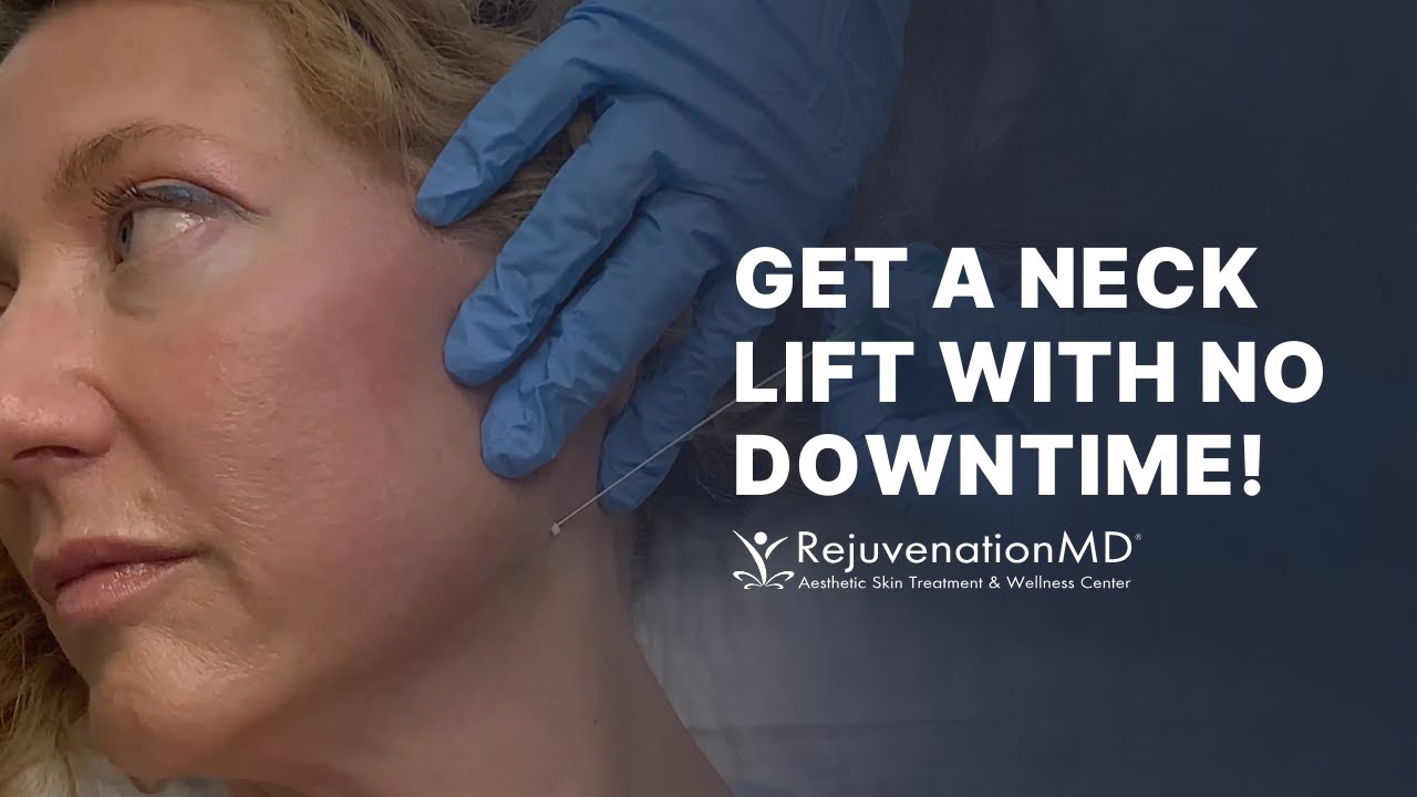 Get a Non-Surgical Neck Lift with PDO Threads! - YouTube