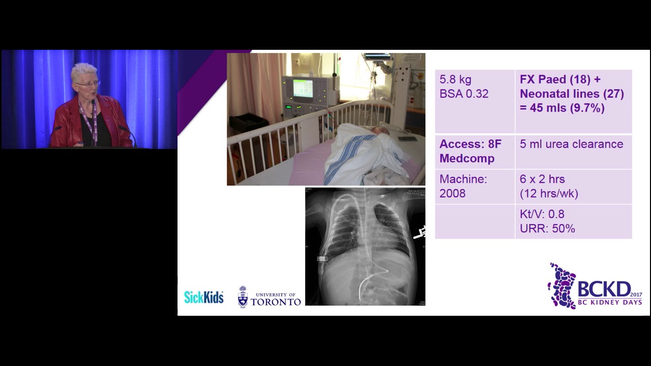 Pediatric Pearls: Dialysis Prescriptions for Petite Patients - YouTube