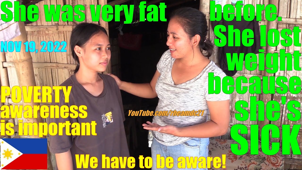 This Filipina Teenager Lost a lot of Weight Because She is Sick ...
