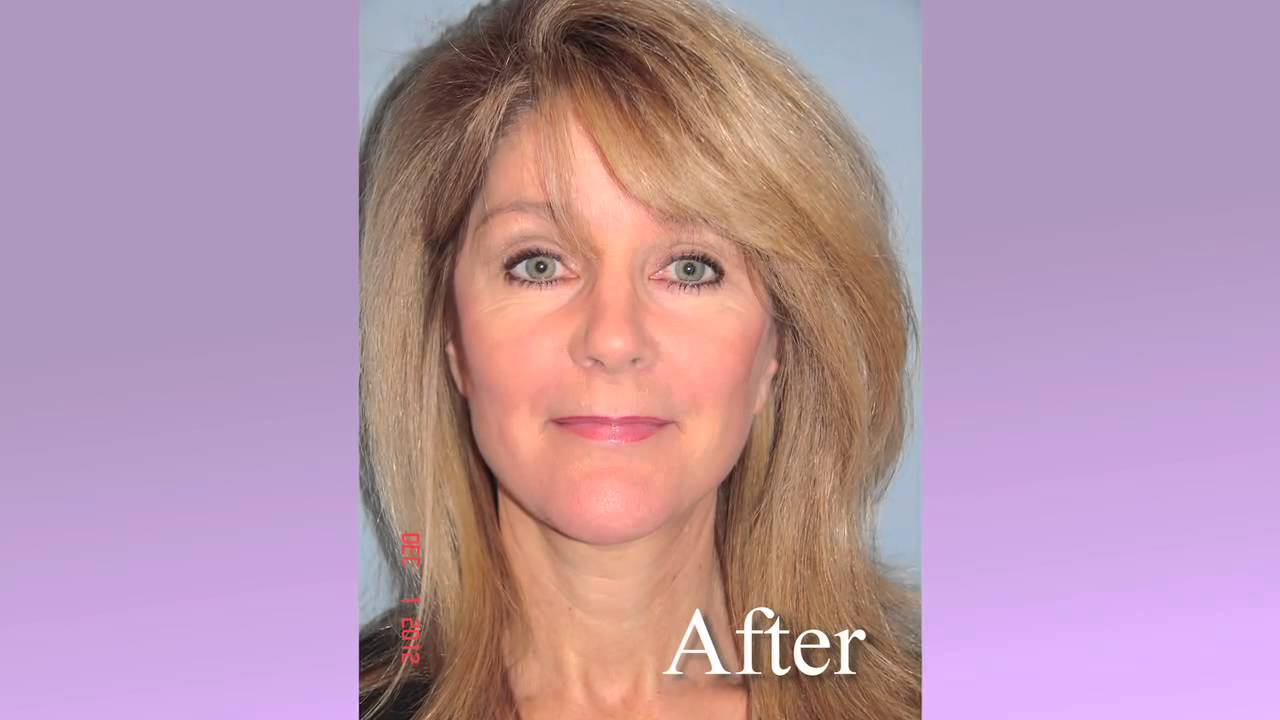 Dr. Pamela Henderson – Patient Review By Karen - YouTube