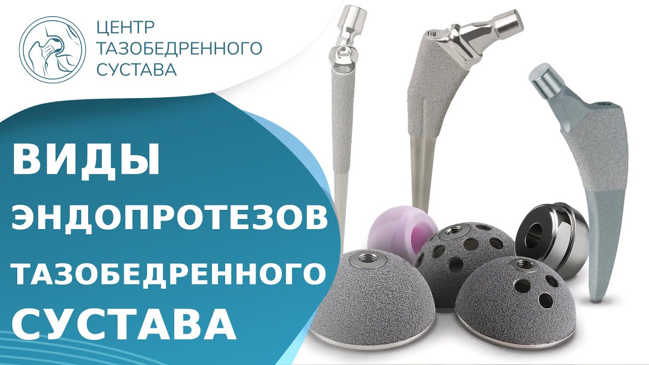 🦿 Какой вид эндопротеза тазобедренного сустава лучше Виды эндопротезов