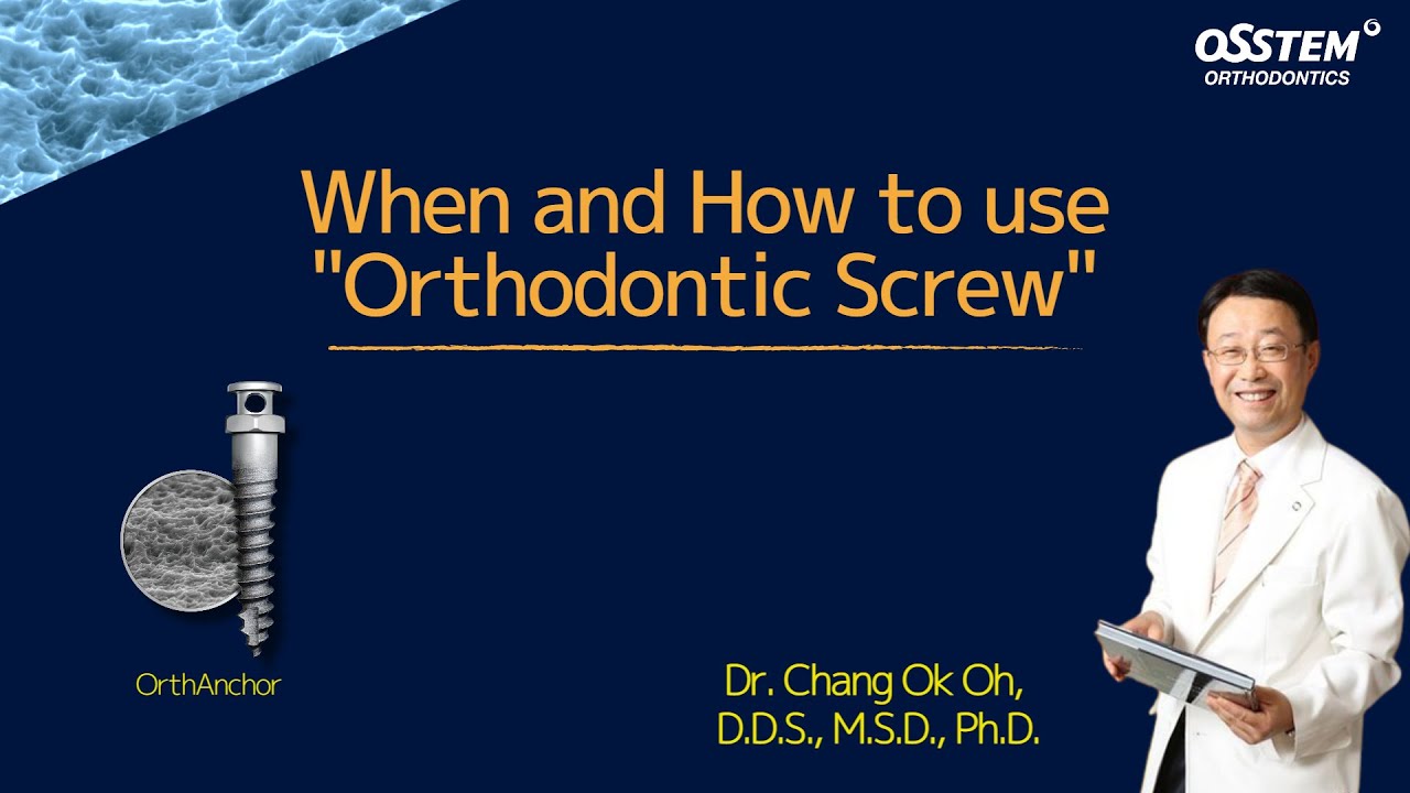 When and How to use "Orthodontic Screw" (All Lectures Edition 1~12 ...