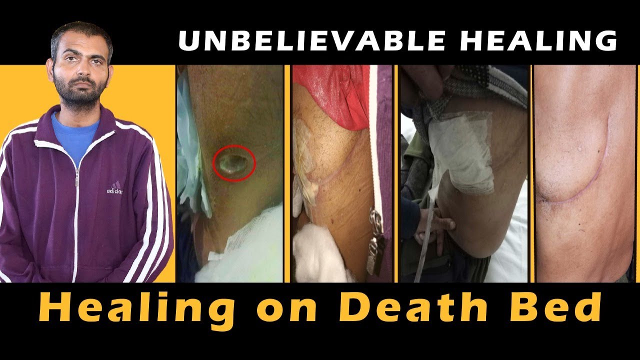 UNBELIEVABLE HEALING !! HEALING ON DEATH BED !! - YouTube