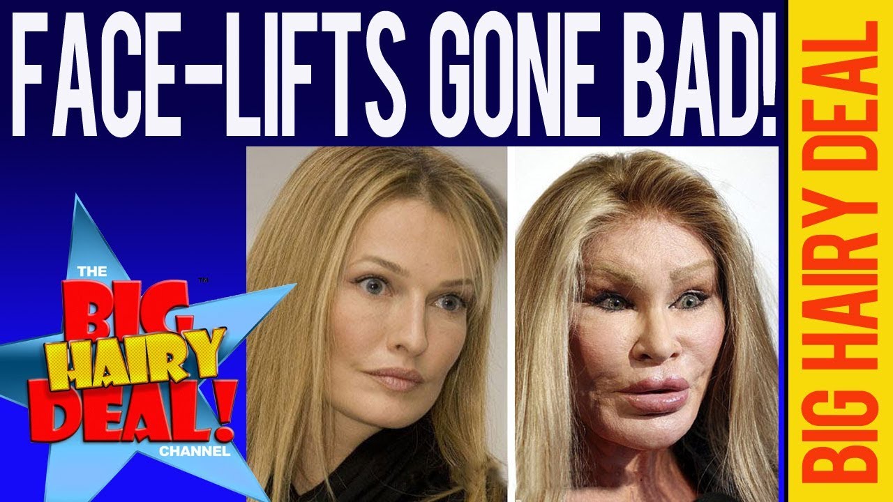 Facelifts Gone Bad - YouTube
