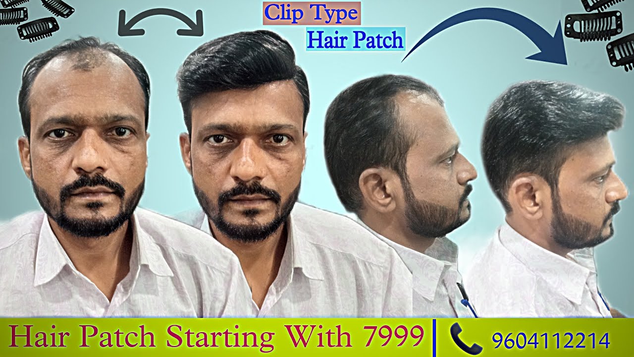 #clippinghairpatch Clip Type Hair Patch | Removable Hair Patch | Hair ...