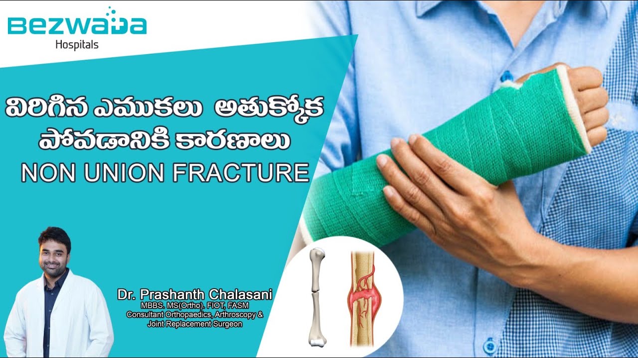 Causes of Non-Union Fractures | Dr. Prashanth Chalasani | Bezwada ...