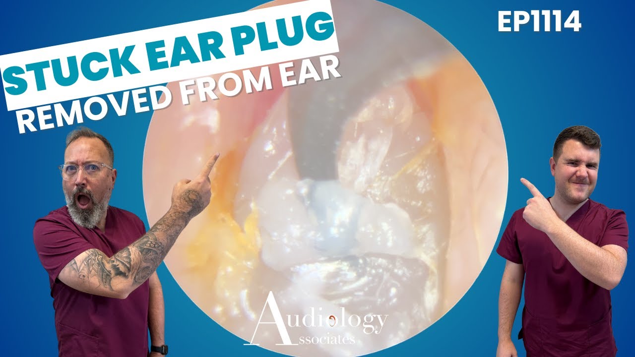 HELP! MY EAR PLUG IS STUCK! - EP1114 - YouTube