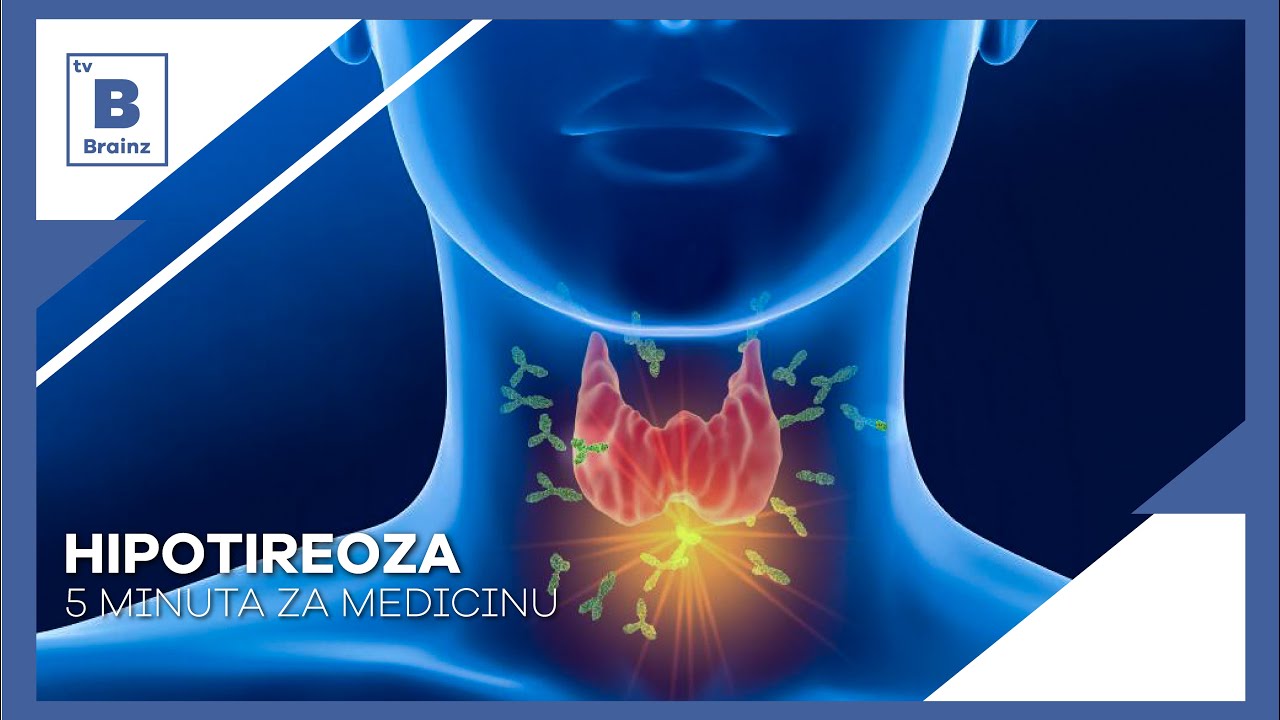 5 minuta za medicinu - Hipotireoza - YouTube