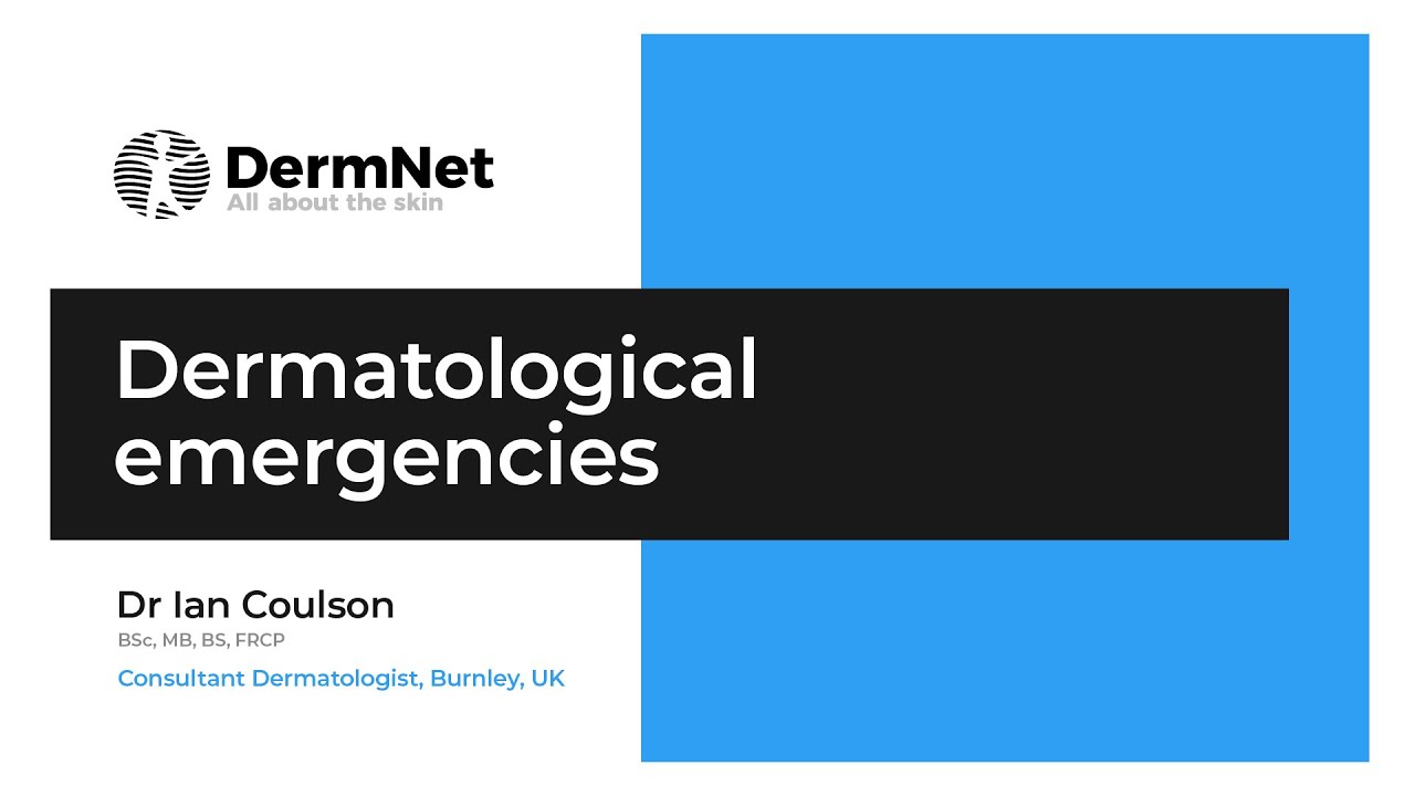 Dermatological emergencies - YouTube