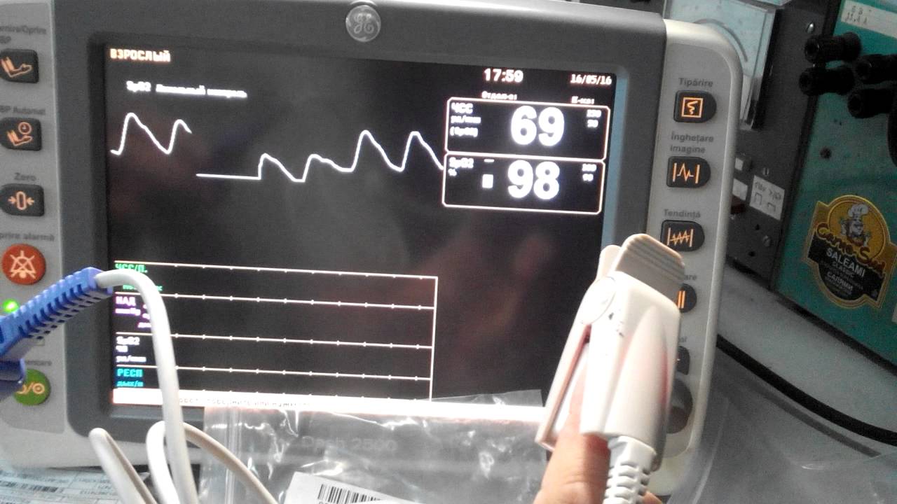 Problem with SPO2 sensor - YouTube