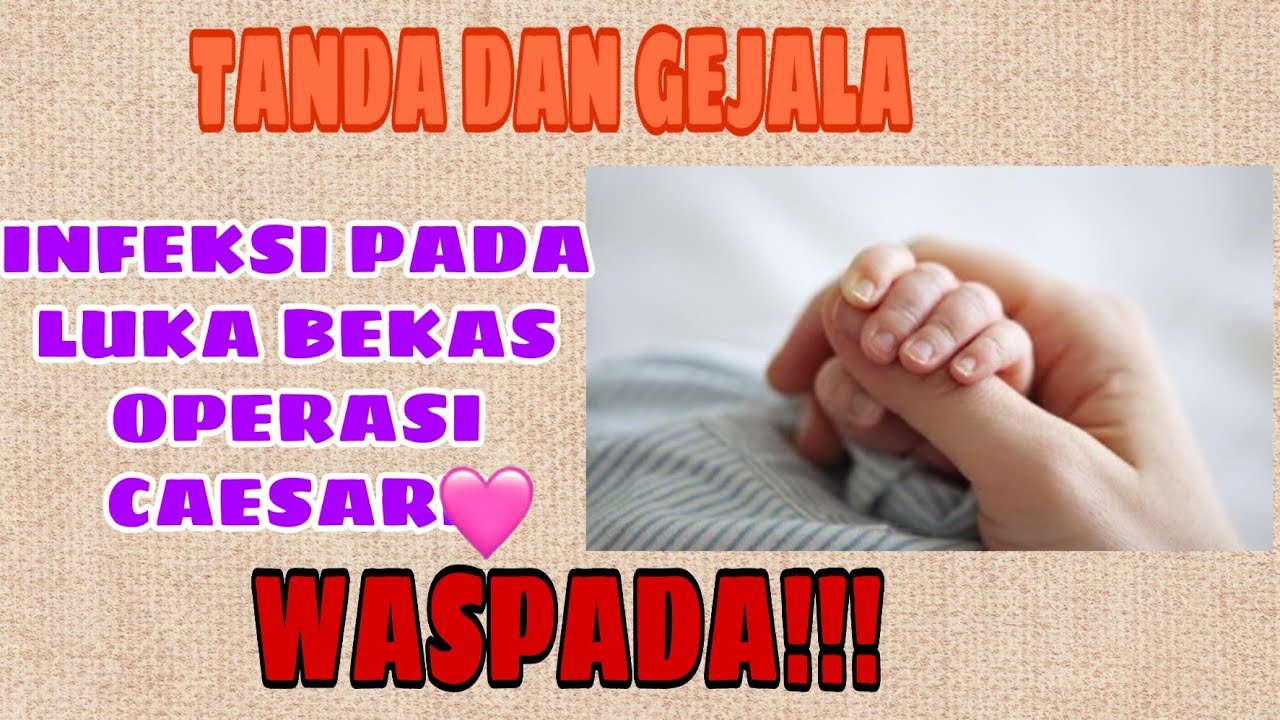 TIPS KENALI TANDA DAN GEJALA INFEKSI LUKA BEKAS OPERASI CAESAR (BISA ...