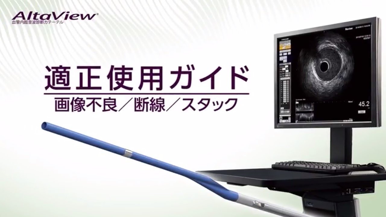 AltaView 適正使用ガイド -画像不良、断線、スタック編- - YouTube