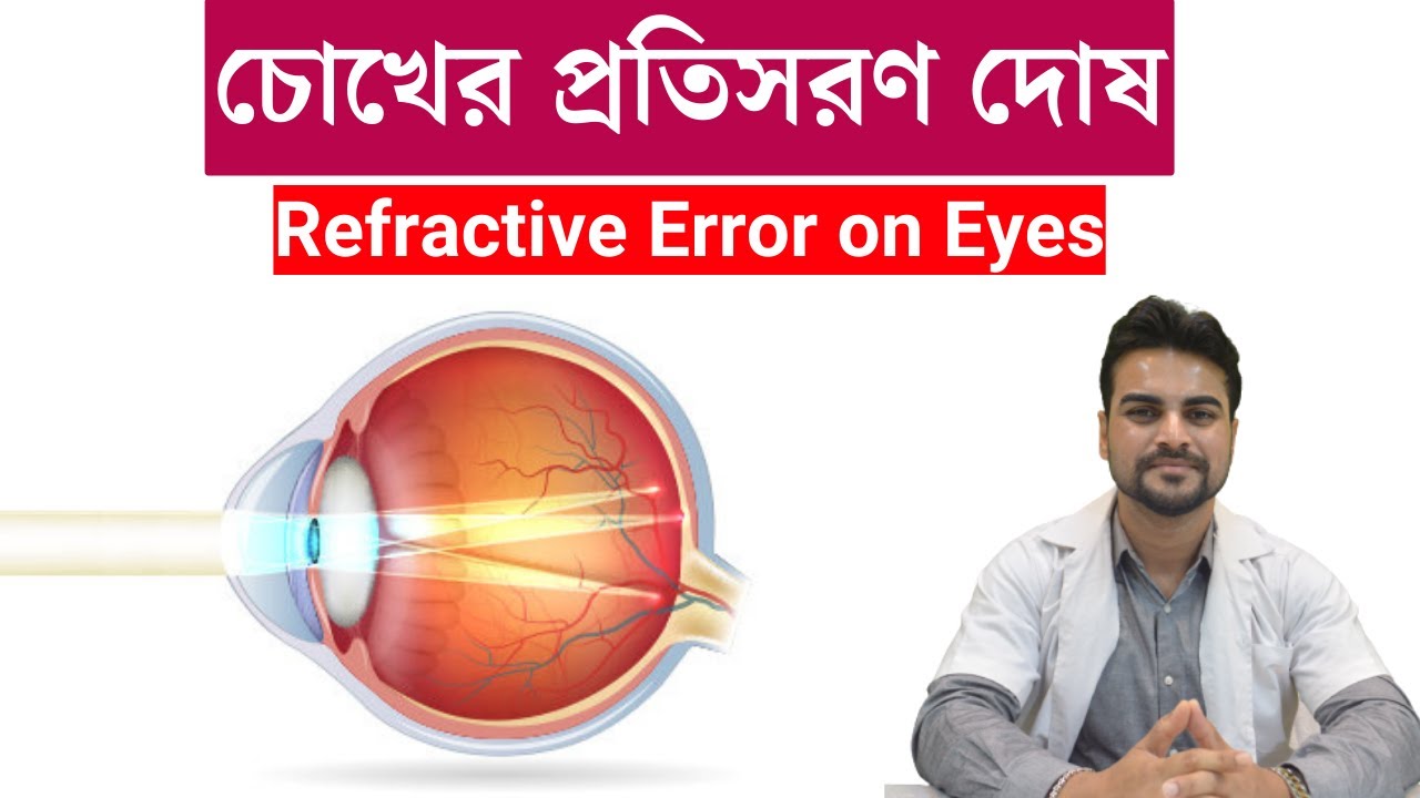 Refractive errors of eye: causes, types, and treatment. # ...
