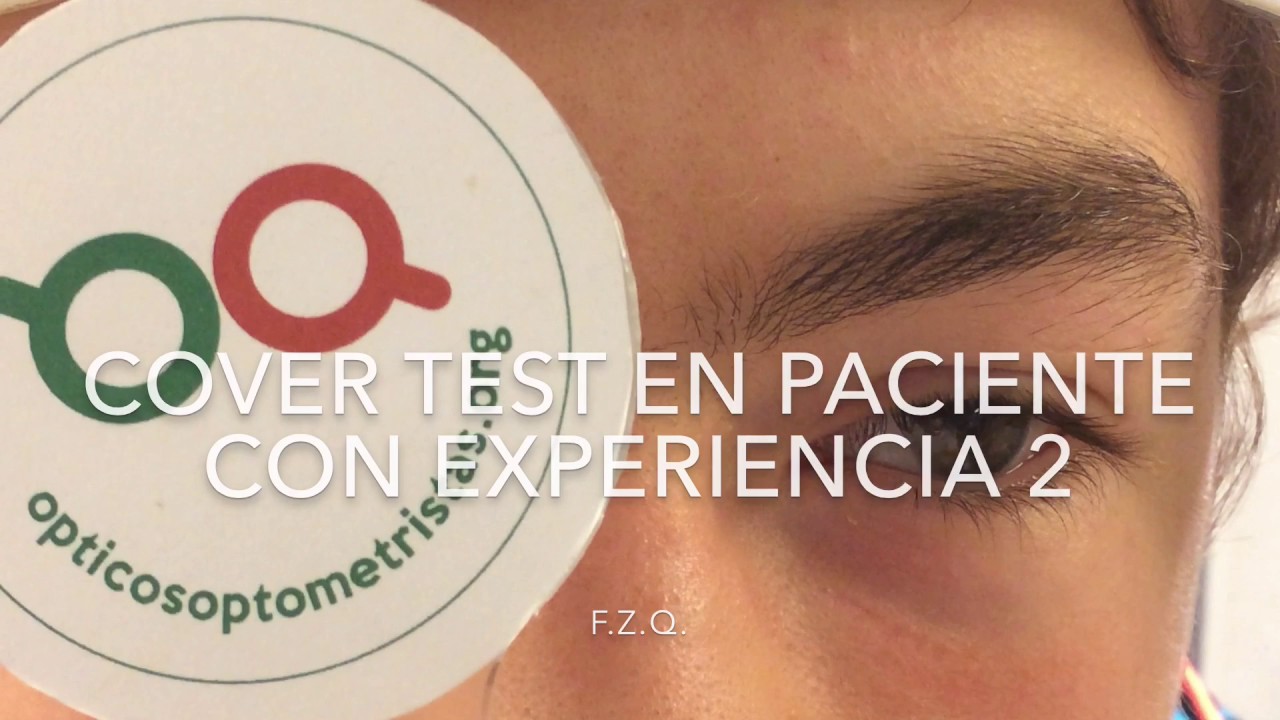 Cover test en paciente con experiencia 2/2 (endotropia alternante ...