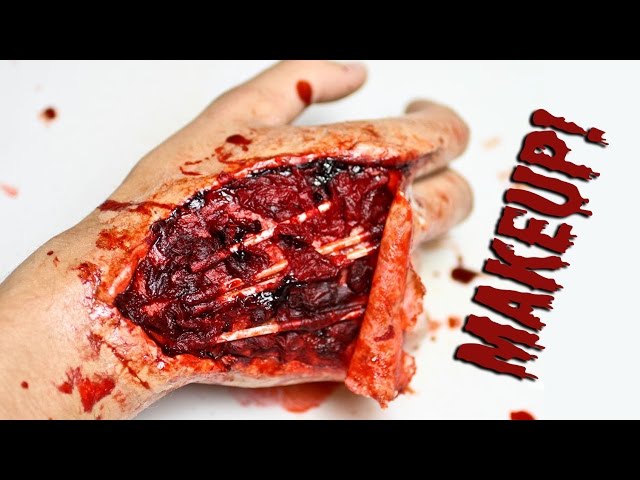 Hand Injury Fake Snap
