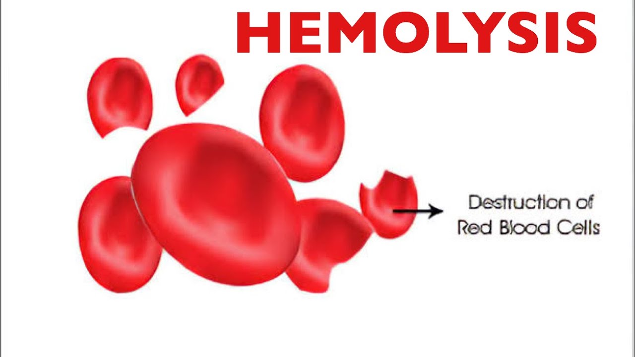 Hemolysis: A general overview - YouTube