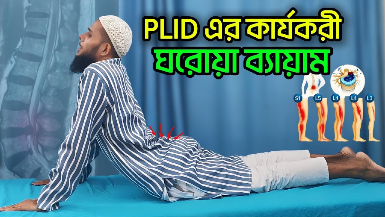 PLID জনিত কোমর ব্যথার ঘরোয়া সমাধানের ব্যায়াম│ Back Extension ...