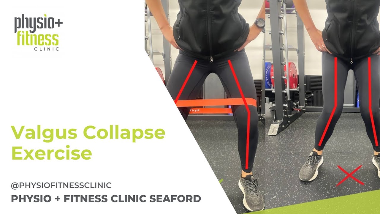 Physio and Fitness Clinic - Easy Valgus Collapse Exercise - YouTube