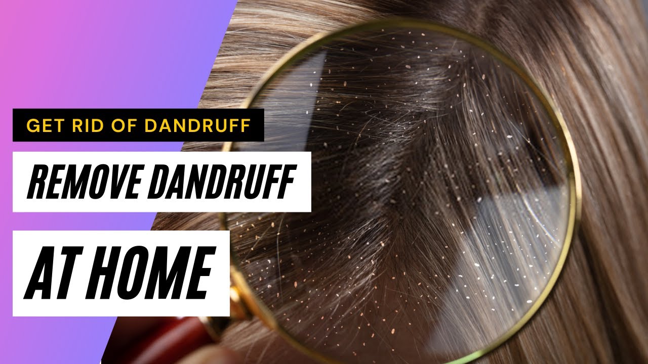 11 Natural Remedies To Get Rid Of Dandruff At Home | Homemade Dandruff ...