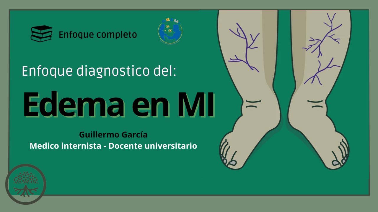 Enfoque diagnóstico del paciente con edema en miembros inferiores ...