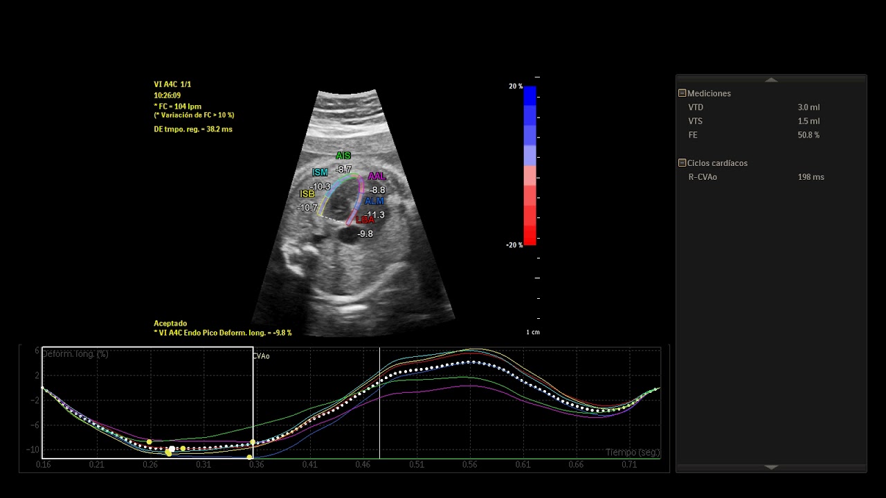 Philips. Eco Strain Fetal. - YouTube
