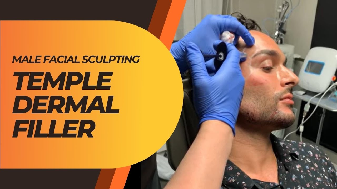 Male Facial Sculpting | Temple Dermal Filler | New York, NY | Dr. Jason ...