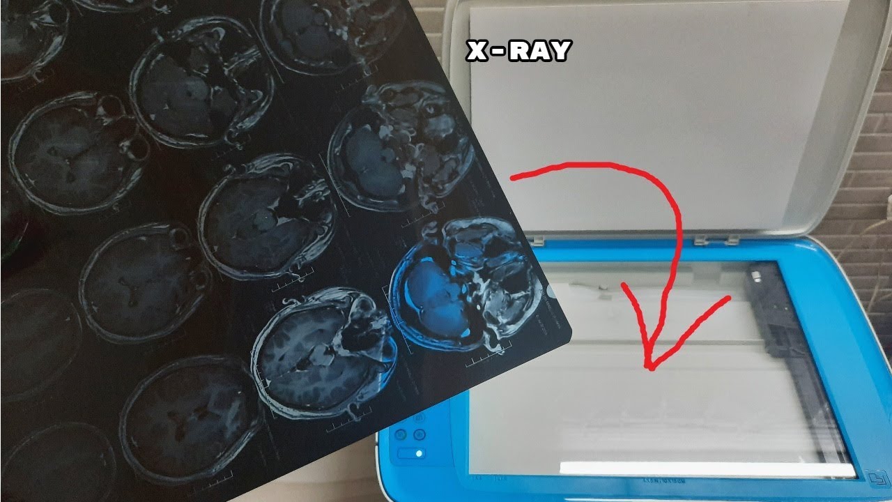 What Happens When You Photocopy An X-Ray - YouTube