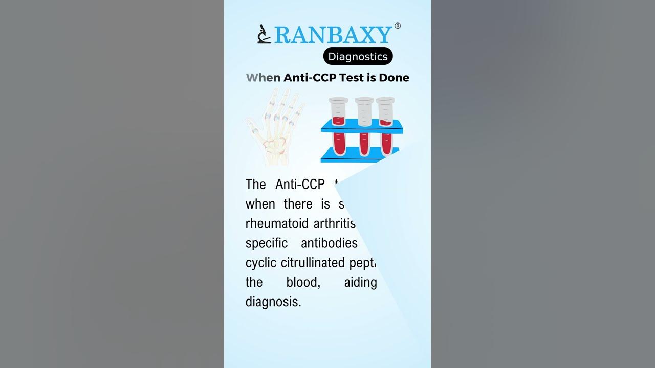 Check Your Status Of Rheumatoid Arthritis With Anti CCP Blood Test check-your-status-of-rheumatoid-arthritis-with-anti-ccp-blood-test