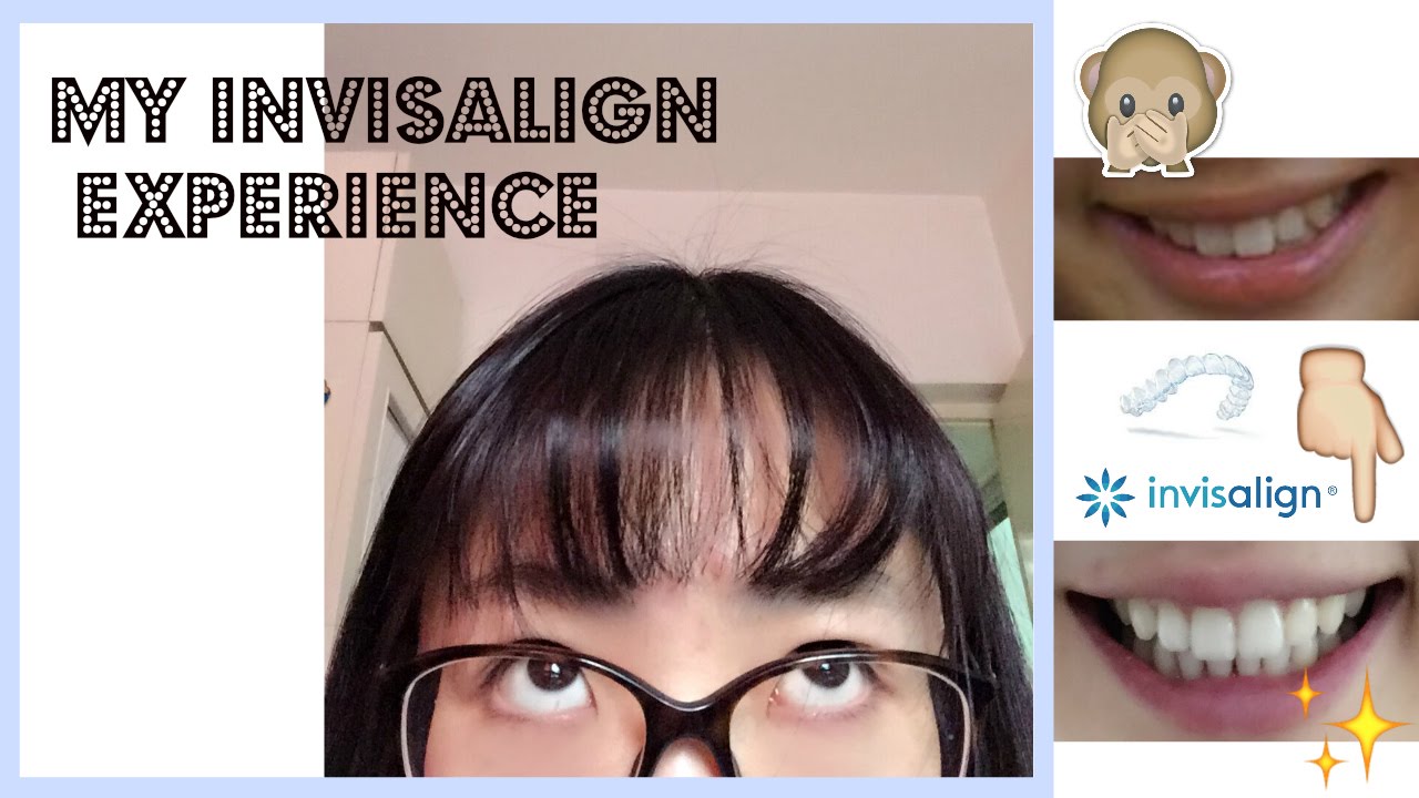 佩戴隐适美牙套的经验分享| My Invisalign Experience｜YIFAAAAN - YouTube