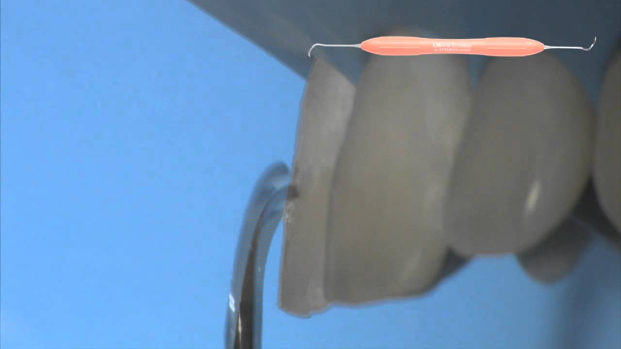 LM Arte - Eccesso - YouTube