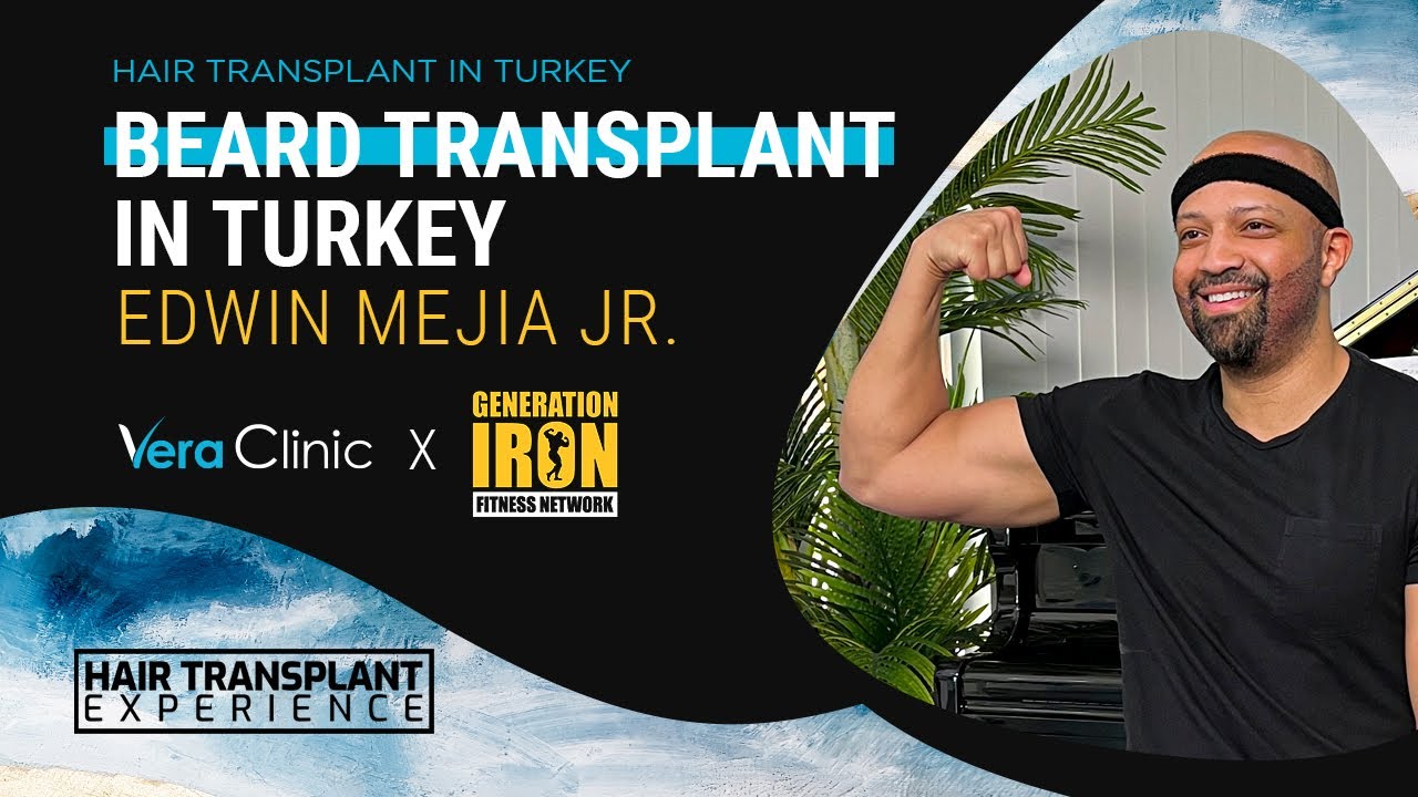 @GenerationIron Edwin Mejia JR. at Vera Clinic #hairtransplant #hairtransplantturkey # ...