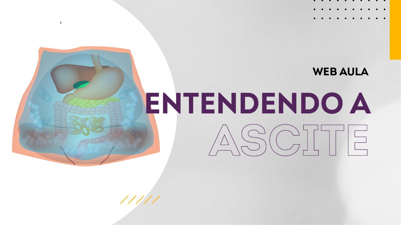 Como tratar a ascite | Web Aula gratuita #121 - YouTube