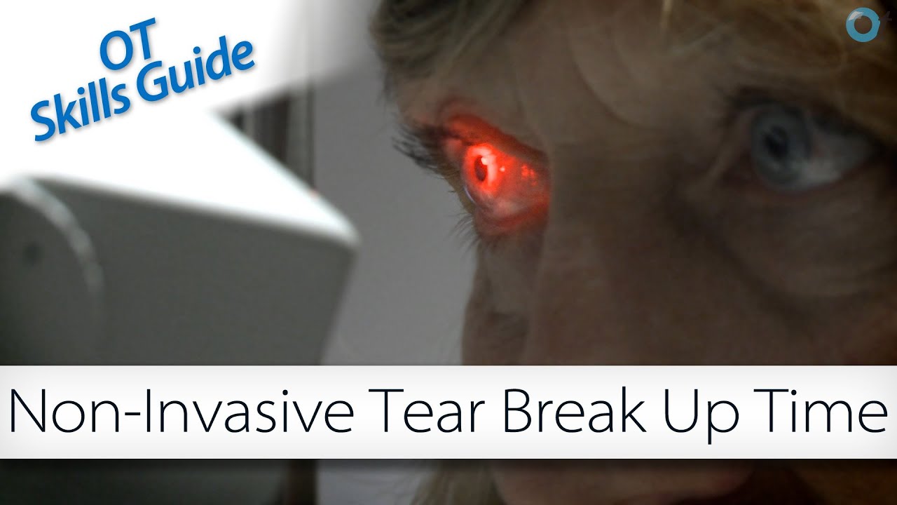 OT skills guide: non-invasive tear break-up time - YouTube