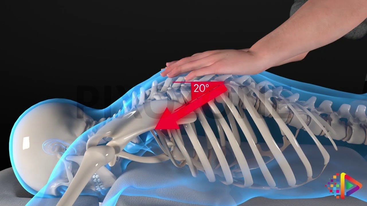Manipulation (Bone Popping) | Frictionless Skin-Bone Interface ...