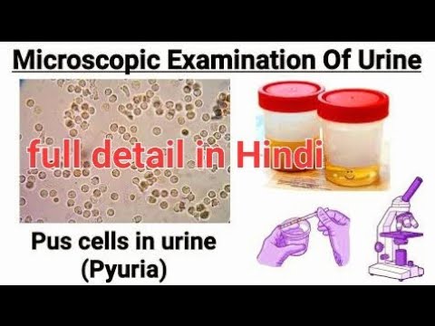 urine infection pus ces(pyuria)#dmlt #pathology #laboratory #bmlt # ...