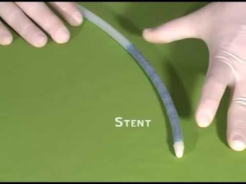 Colocación de stent esofágico: INSTRUMENTAL - YouTube