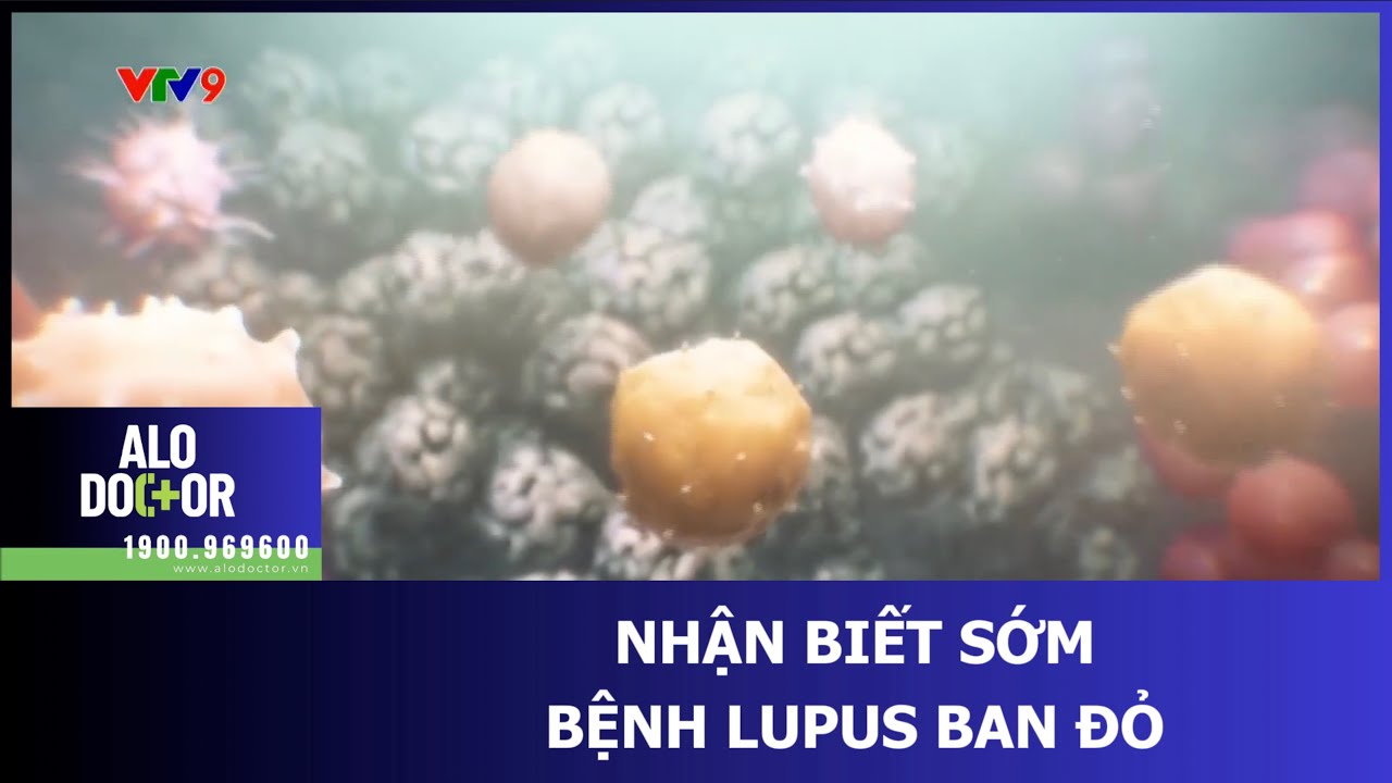 NHẬN BIẾT SỚM BỆNH LUPUS BAN ĐỎ - YouTube