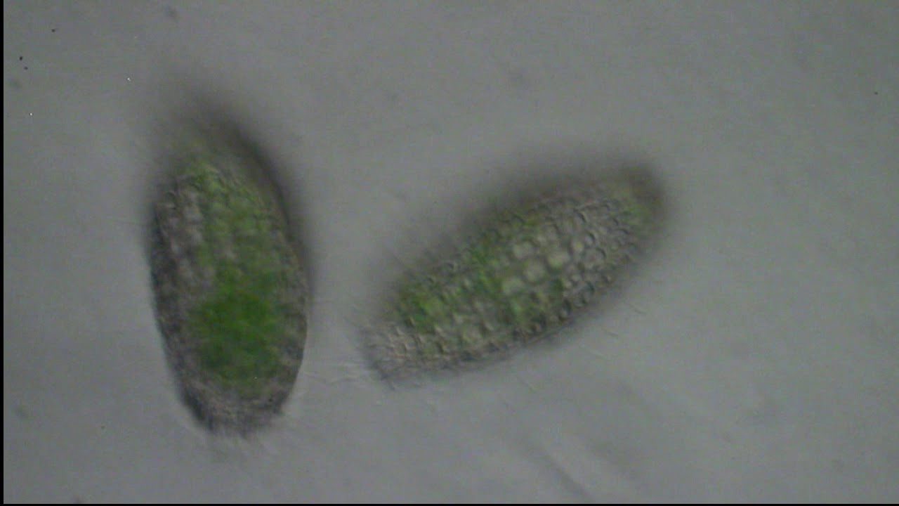 Coleps hirtus viridis bei unterschiedlichen Vergrößerungen - YouTube